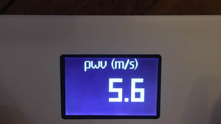 Review: Body Cardio, a stylish scale that keeps tabs on your heart health