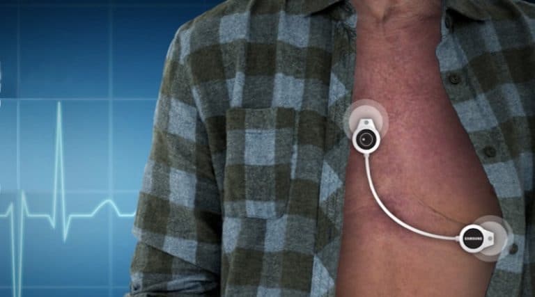 Samsung S-Patch Cardio continuous ECG monitor gets FCC approval