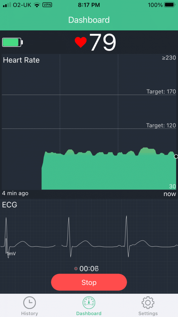 Review: Guard your heart with Wellue Heart Health Monitor