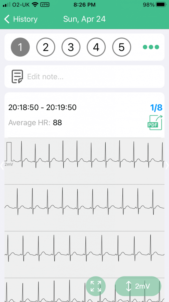 Review: Guard your heart with Wellue Heart Health Monitor