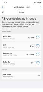 Garmin is preparing a new health status timeline feature